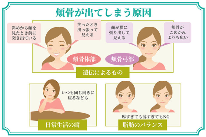 頬骨が出ている原因は?自分でできる対策を詳しく解説 銀座マイアミ美容外科